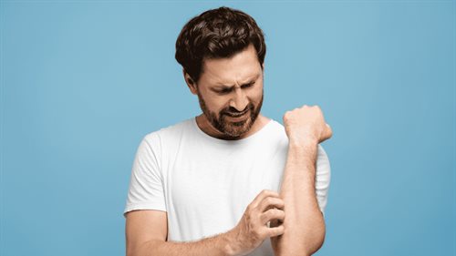 Qué hacer: ¿rascarse o no rascarse? - Diario Libre